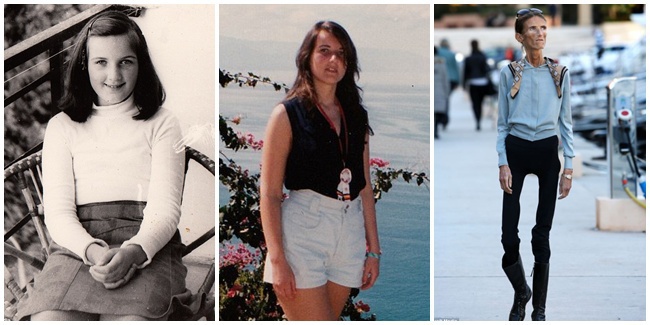 La femme la plus maigre du monde ne pèse que 25 kilos