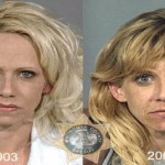 Les ravages de la drogue sur le physique de 11 personnes - l'évolution ...