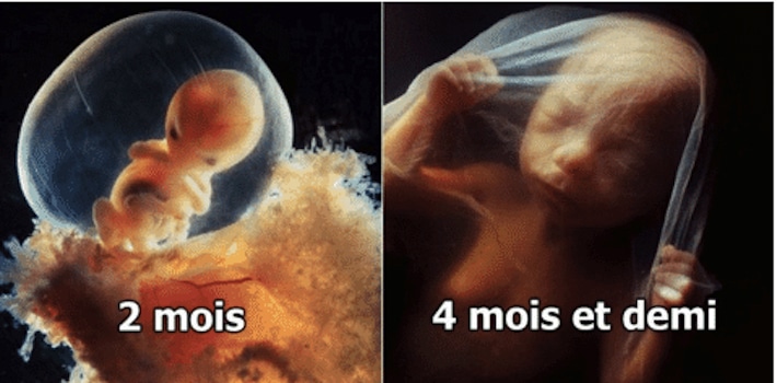 L'évolution d'un foetus dans le ventre de sa mère en 21 photos ...