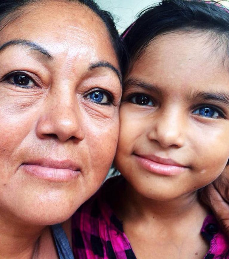 Découvrez 9 photos sublimes de personnes et d'animaux atteints d ...