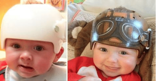 Merveilleux ! Cette artiste customise les casques de bébés victimes du ...