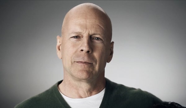 Une étude prouve qu'être chauve, c'est mieux que d'avoir des cheveux