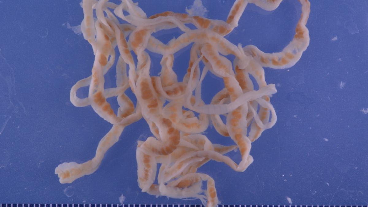 Il a un ver solitaire d'1,7 mètres dans le ventre après avoir abusé de ...