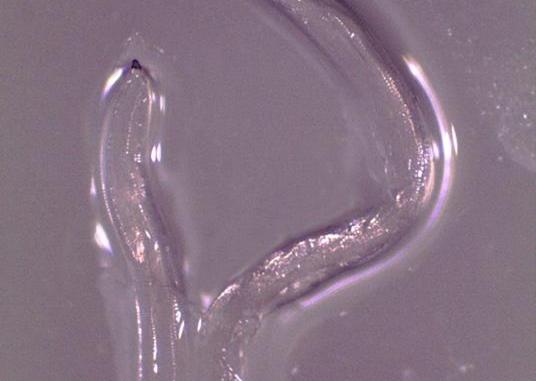 En Oregon, une femme découvre un ver dans son oeil