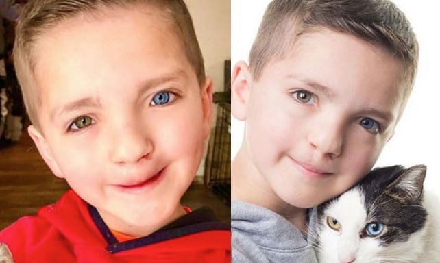 Ce petit garçon a trouvé un chat qui a le même handicap que lui ! (vidéo)