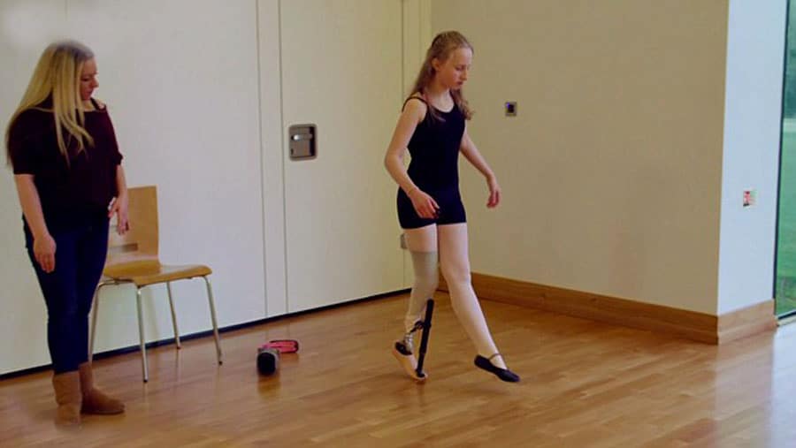 Cette jeune danseuse amputée de la jambe peut faire des pointes grâce à ...
