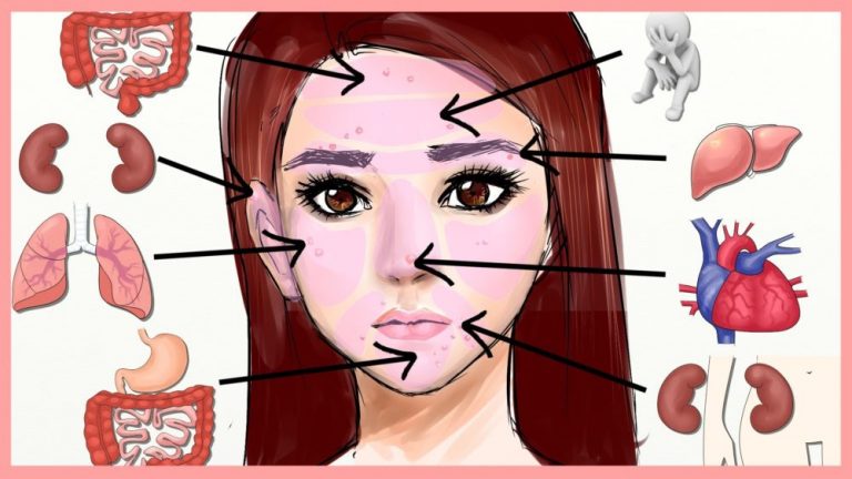 Savez-vous ce que vos boutons révèlent sur votre santé