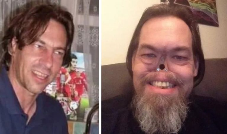 Arrêtez de vous arracher les poils du nez, c'est dangereux