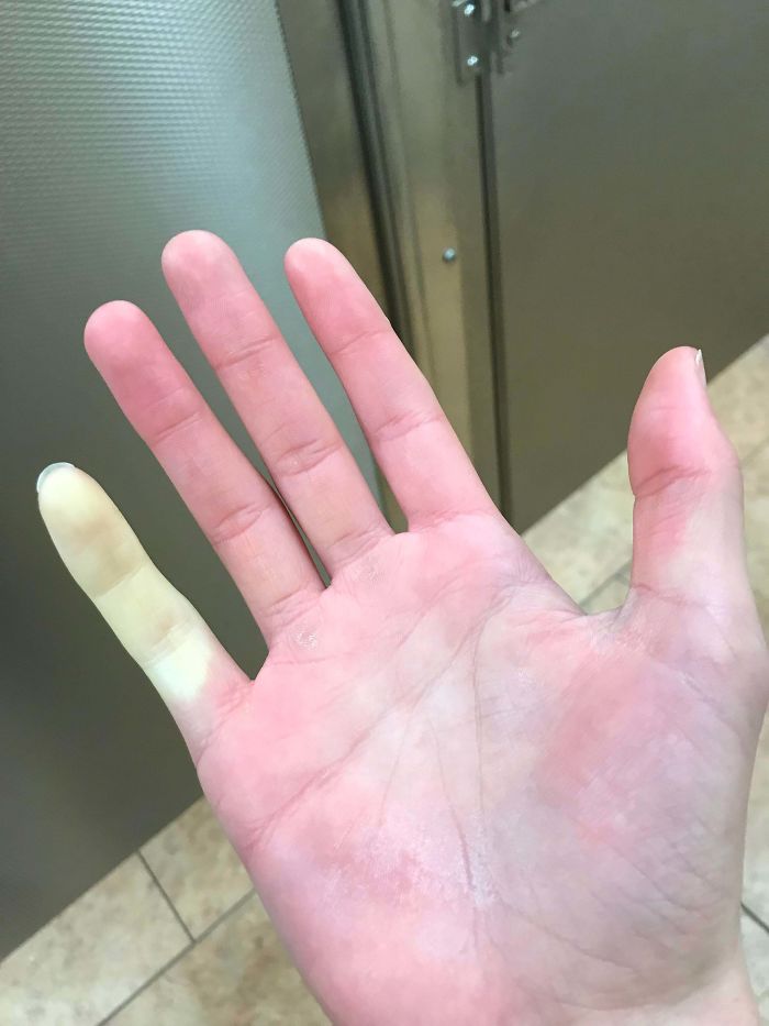 Leur génétique a rendu ces 35 personnes uniques ! - Page 2 sur 7