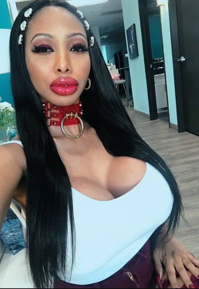 Elle a dépensé 200 000 dollars en chirurgie esthétique et le résultat est... troublant