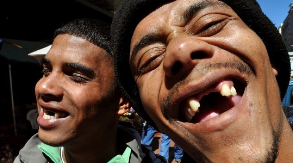 Ils se font arracher les dents de devant pour une raison vraiment ...