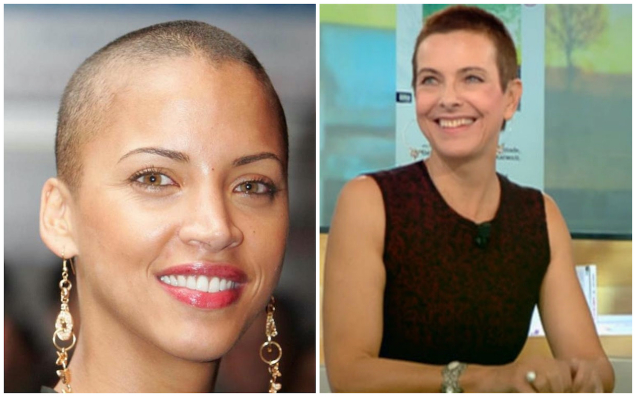 Carole Bouquet, Noémie Lenoir : Ces stars qui se sont rasées le crâne