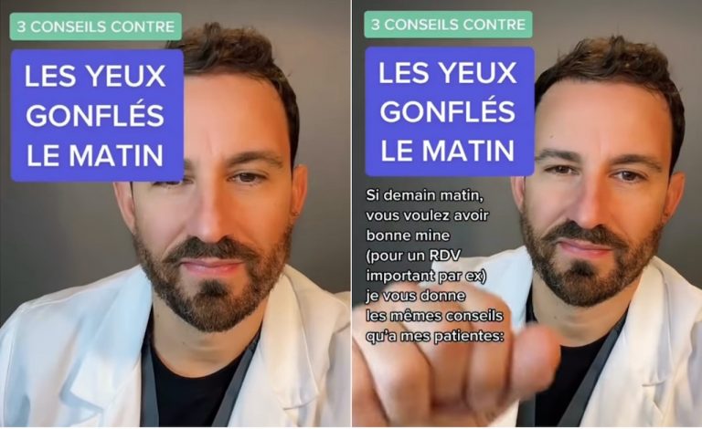 Vous avez les yeux gonflés au réveil ? Les conseils de ce chirurgien ...