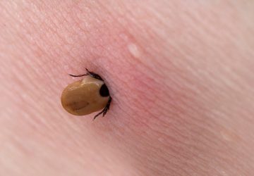 Tiques : 3 règles indispensables pour survivre cet été