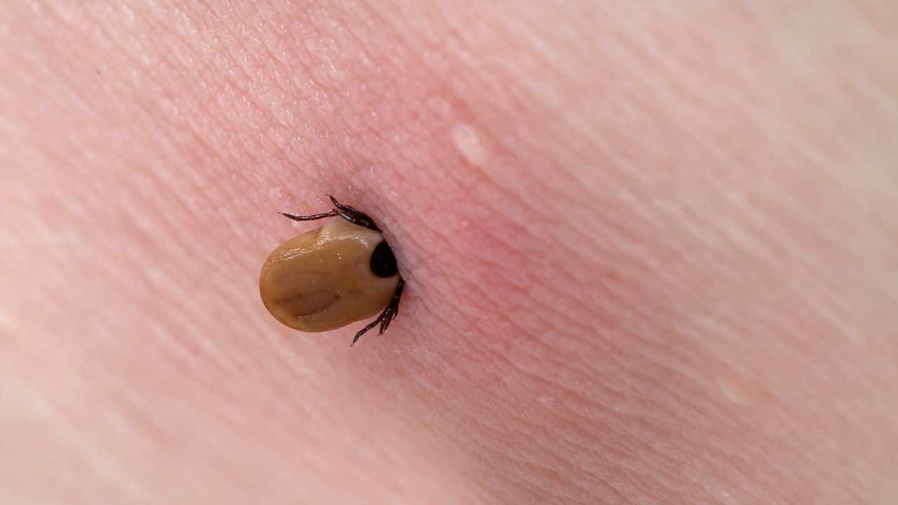 Tiques : 3 règles indispensables pour survivre cet été