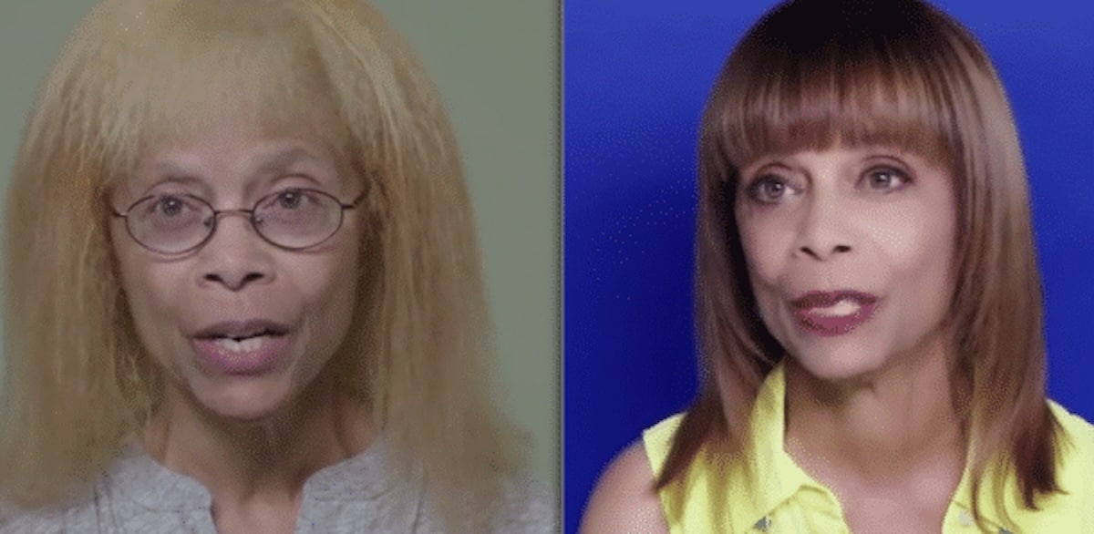 Terriblement complexée par son apparence physique, cette femme a voulu ...
