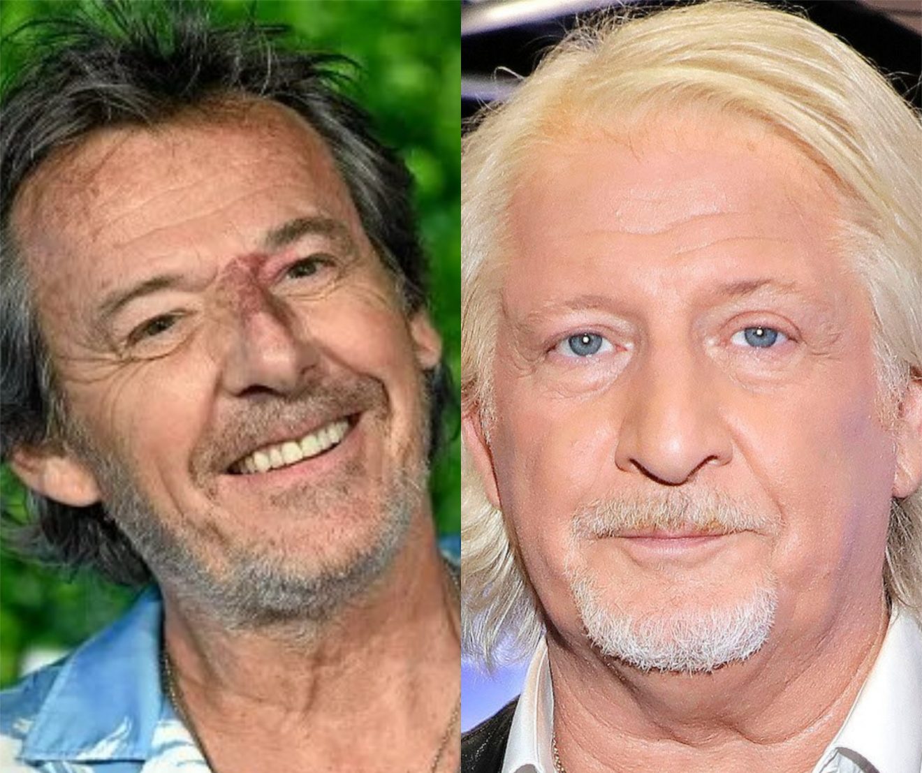 Patrick Sébastien malade ? Ce cliché qui inquiète les fans