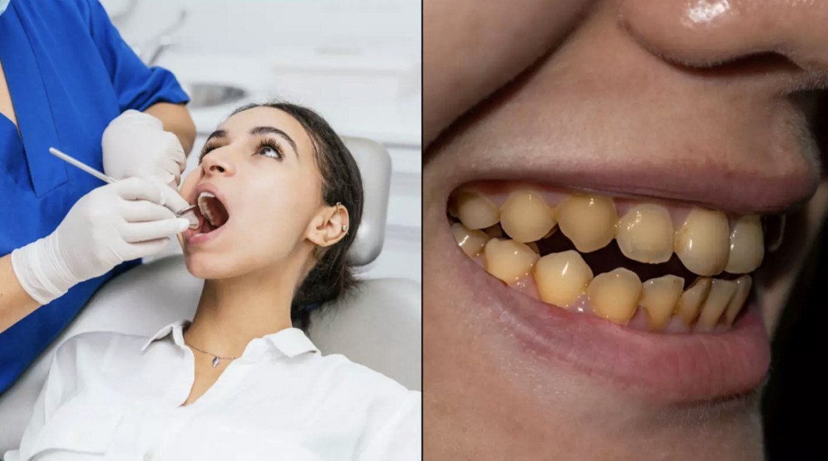 Un dentiste offre quelques astuces pour ne pas avoir les dents jaunes