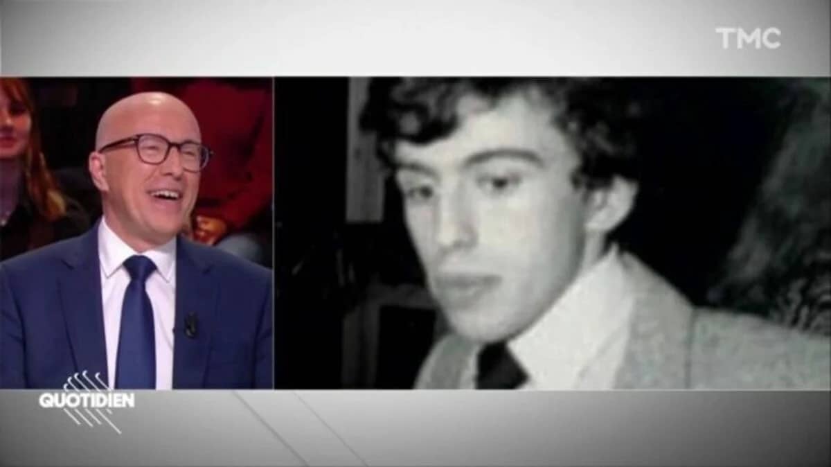 Éric Ciotti : voici à quoi il ressemblait avec des cheveux