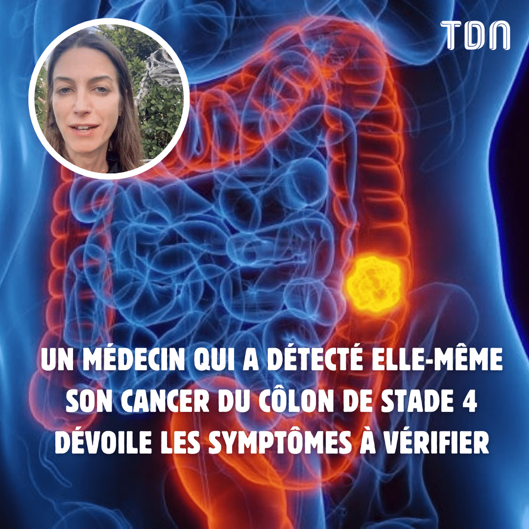 Un médecin qui a détecté elle-même son cancer du côlon de stade 4 ...