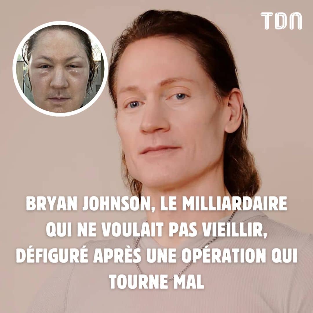Bryan Johnson, le milliardaire qui ne voulait pas vieillir, défiguré ...