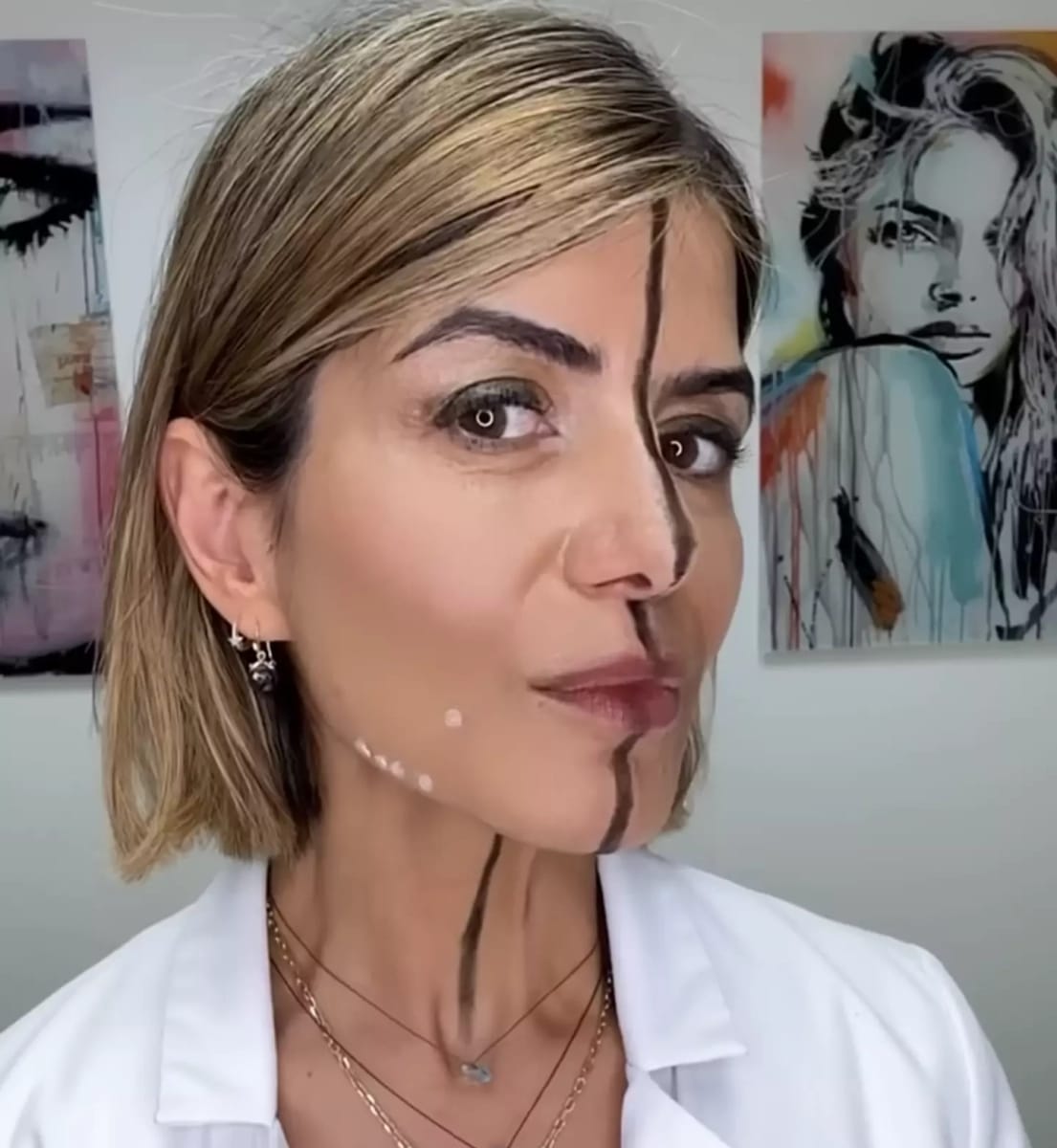 Un médecin montre les effets du Botox en l’utilisant sur la moitié de ...