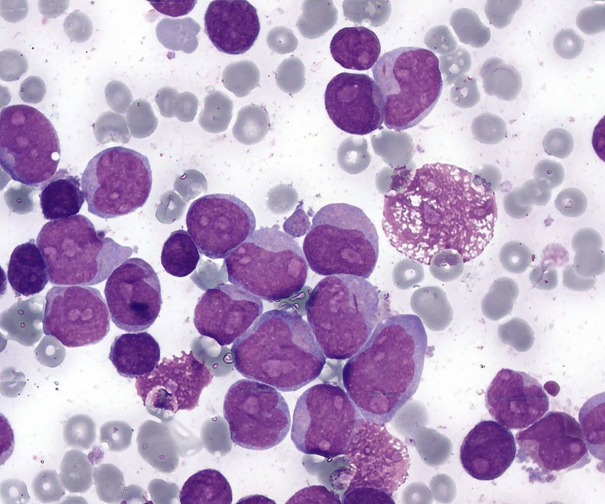 À 21 ans, ses gencives saignaient sans raison : les médecins découvre ...